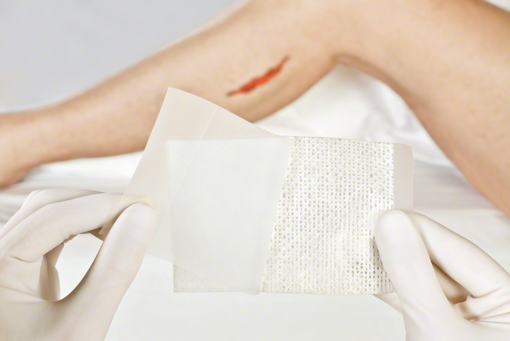 Wound Care: Prevention and Management of Chronic Wounds
